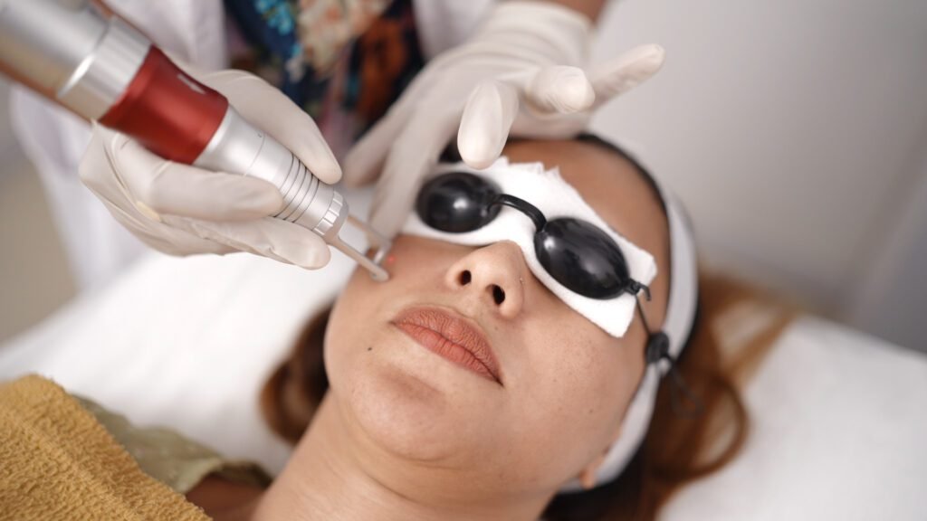 Fractional CO2 Laser Skin Resurfacing For Scars & Wrinkles