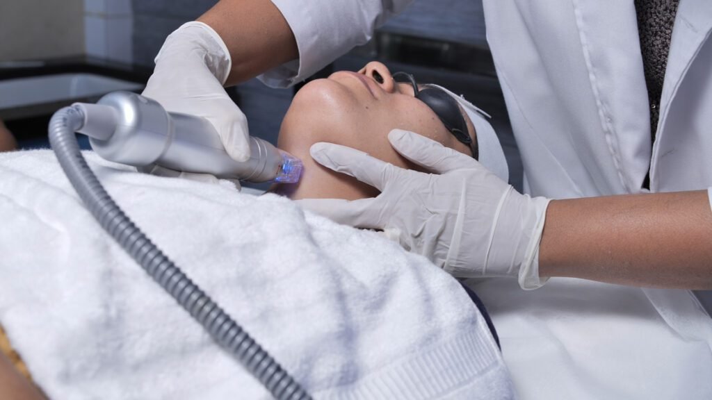 Fractional CO2 Laser Skin Resurfacing For Scars & Wrinkles